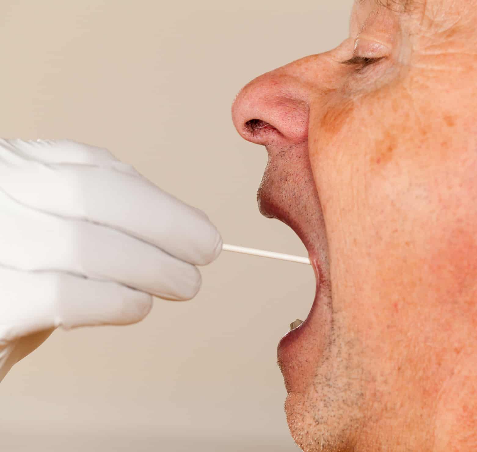 How to Pass a Mouth Swab Drug Test